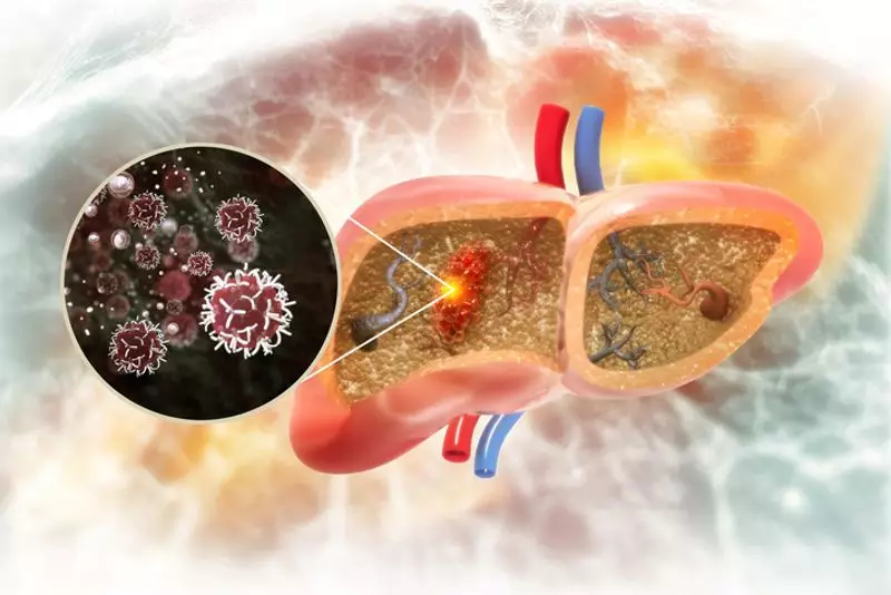 Tezpur University Breakthrough: Blood Test for Gallbladder Cancer ...